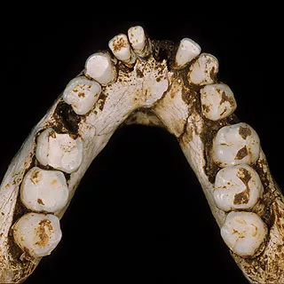 Ancient Teeth Provide Evolutionary Clues - Dental Partners Of Fifth Avenue
