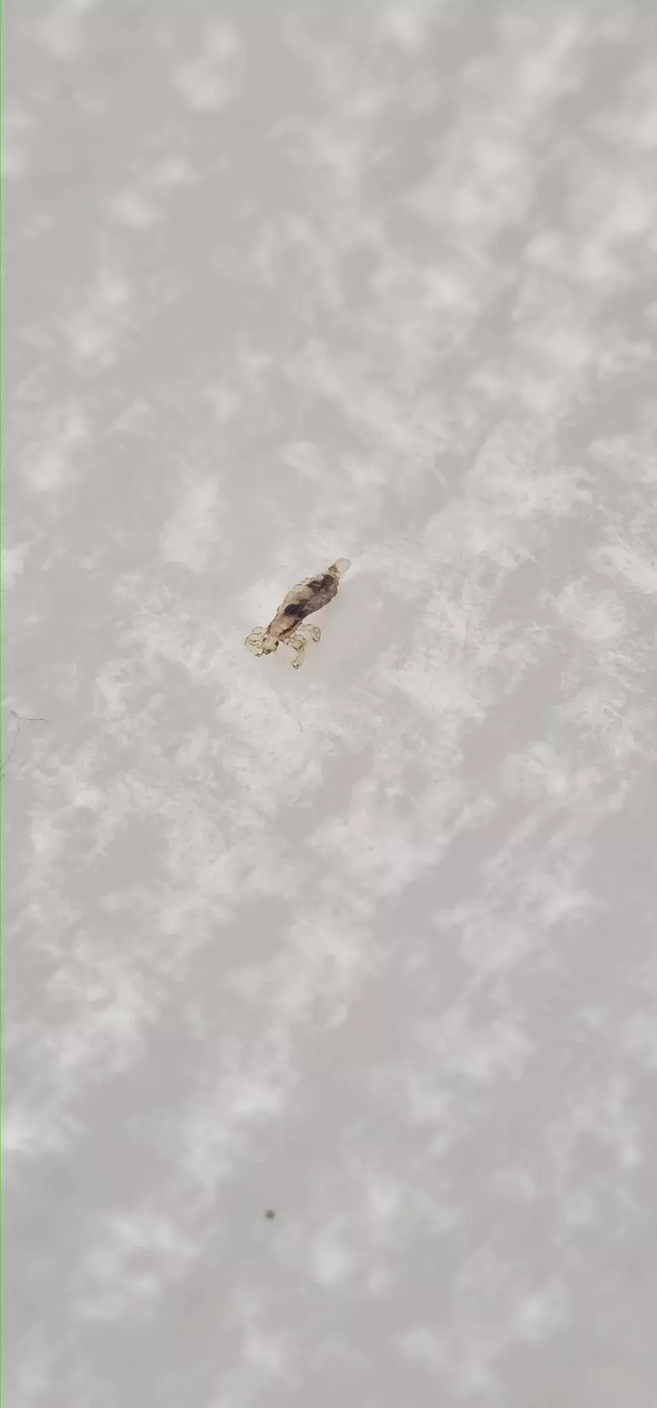 What Does Head Lice Look Like? A Simple Guide from a Lice Expert - Lice Busters