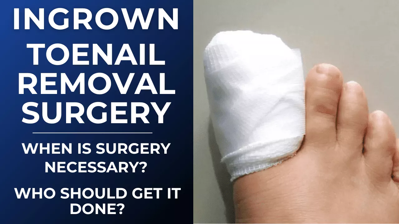 What is Ingrown Toenail removal surgery? How does it work? Does it hurt?
