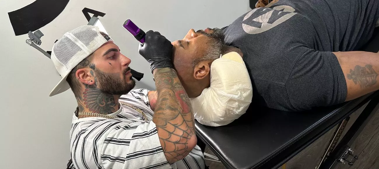 Scalp Micropigmentation For Alopecia