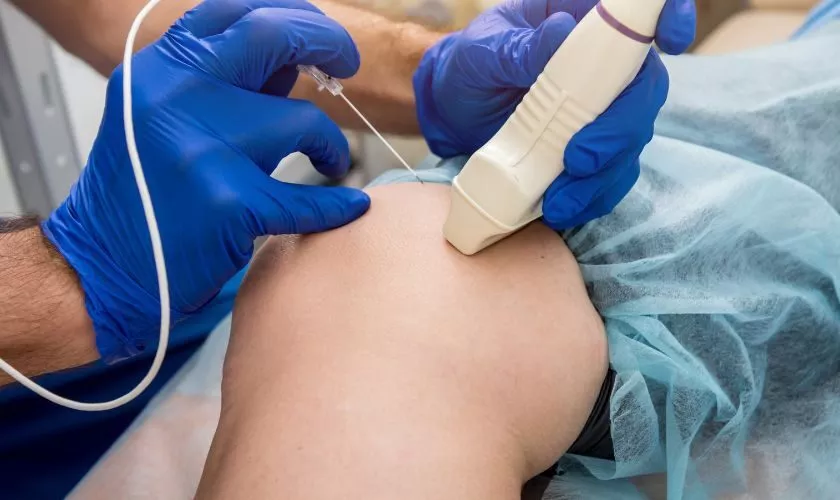 What Is Genicular Nerve Ablation and How Does It Help Knee Pain: A Solution for Knee Pain Relief ...