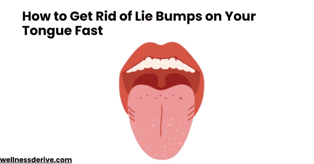 How to Get Rid of Lie Bumps on Your Tongue Fast | Wellness Derive