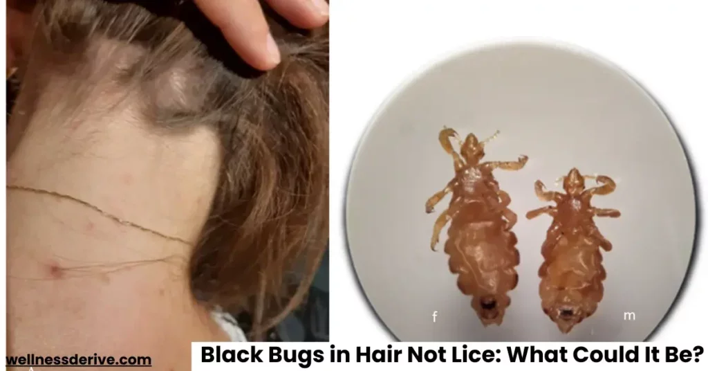 Black Bugs in Hair Not Lice: Identify & Resolve the Mystery