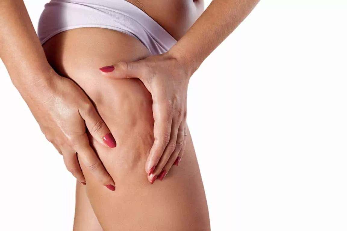 Comment faire disparaître la cellulite sur les cuisses ? - LifeStyle Conseil
